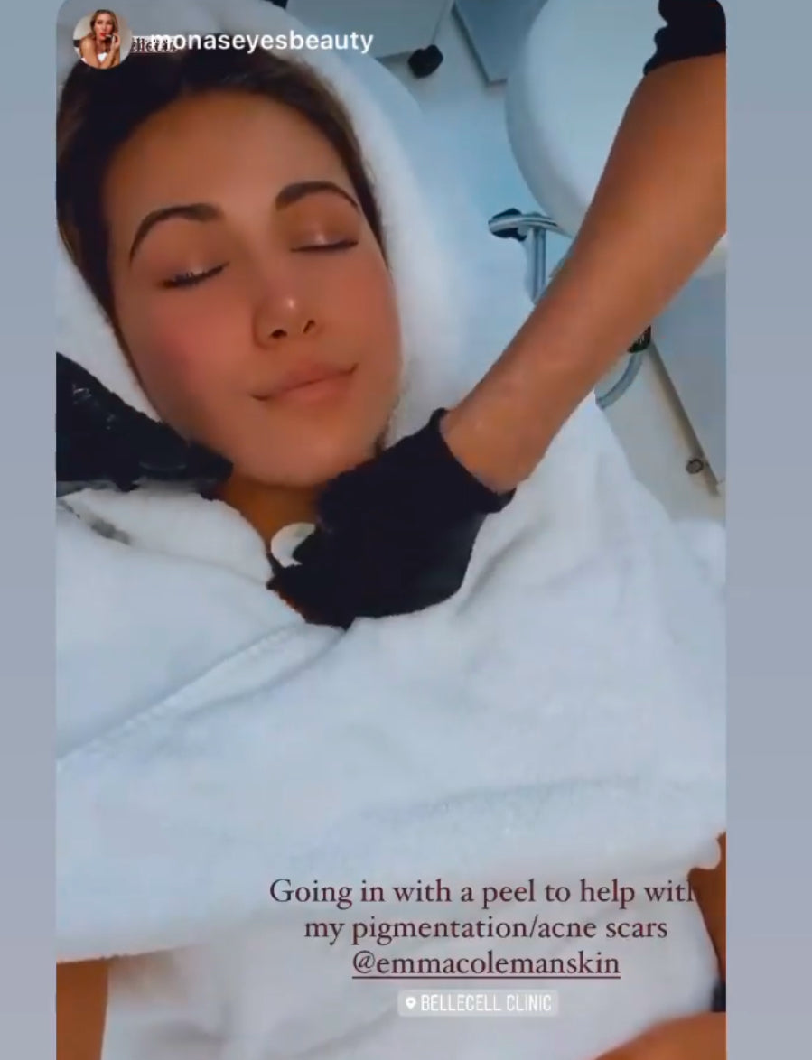Emma's Illumi Facial by Emma Coleman Skin