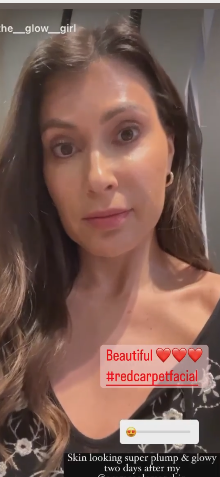 Red Carpet Facial by Emma Coleman Skin